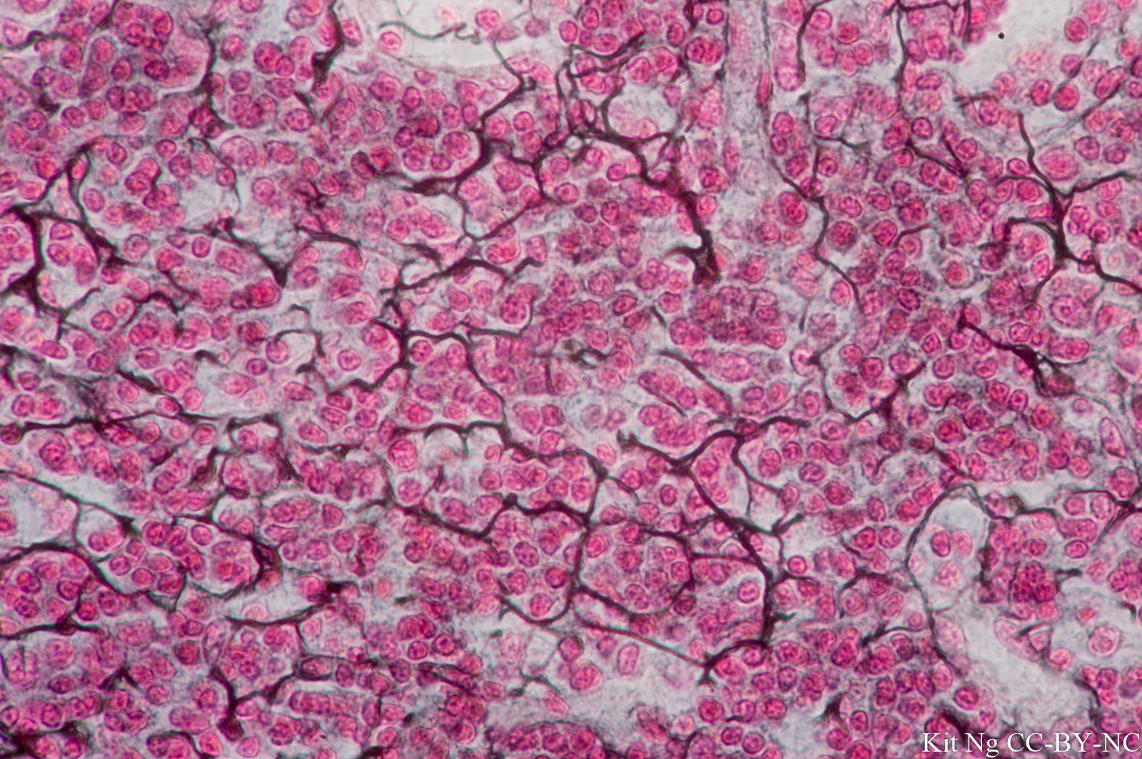 Reticular Fibers – Kit Ng, Ph.D.