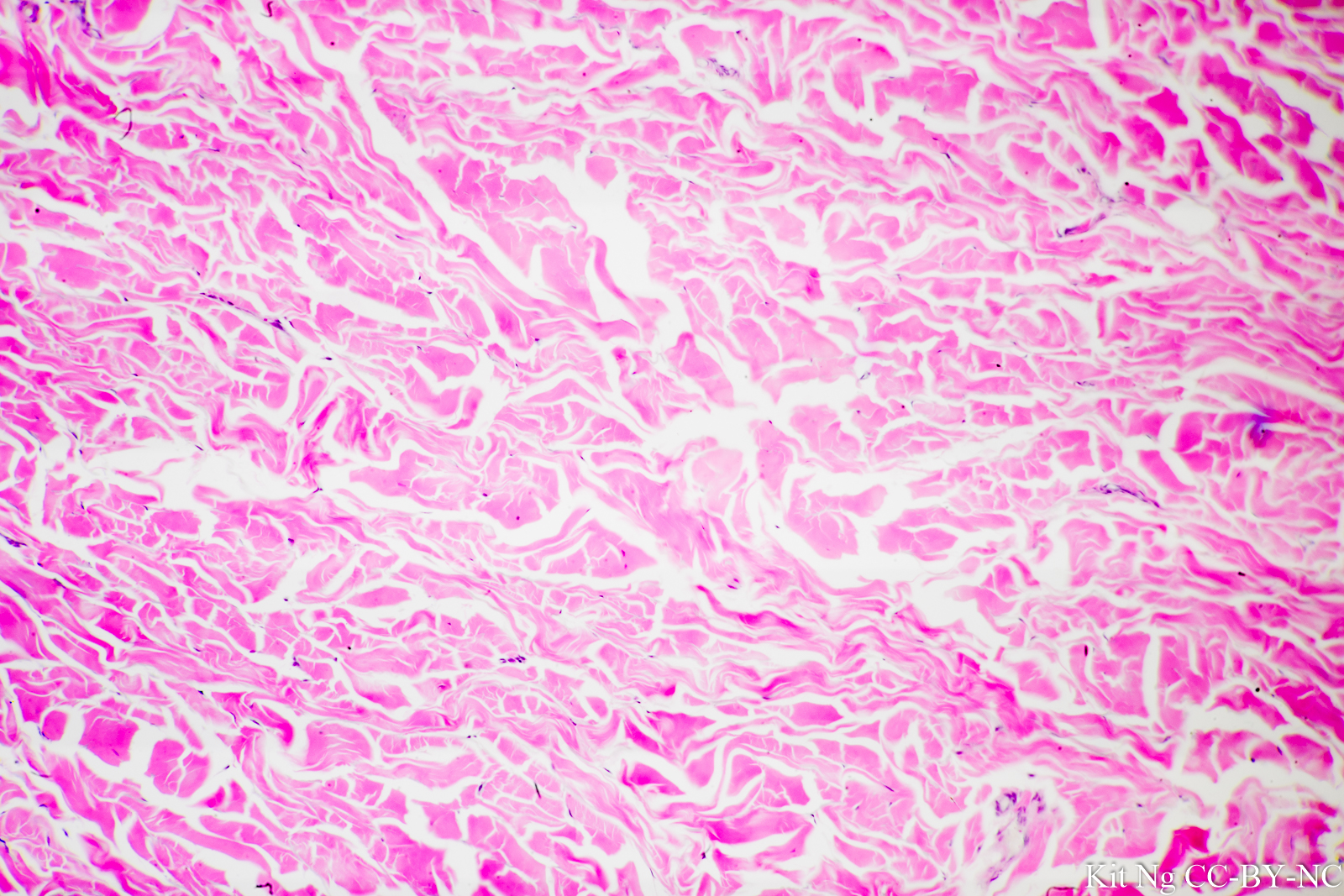 Dense Irregular Connective Tissue – Kit Ng, Ph.D.