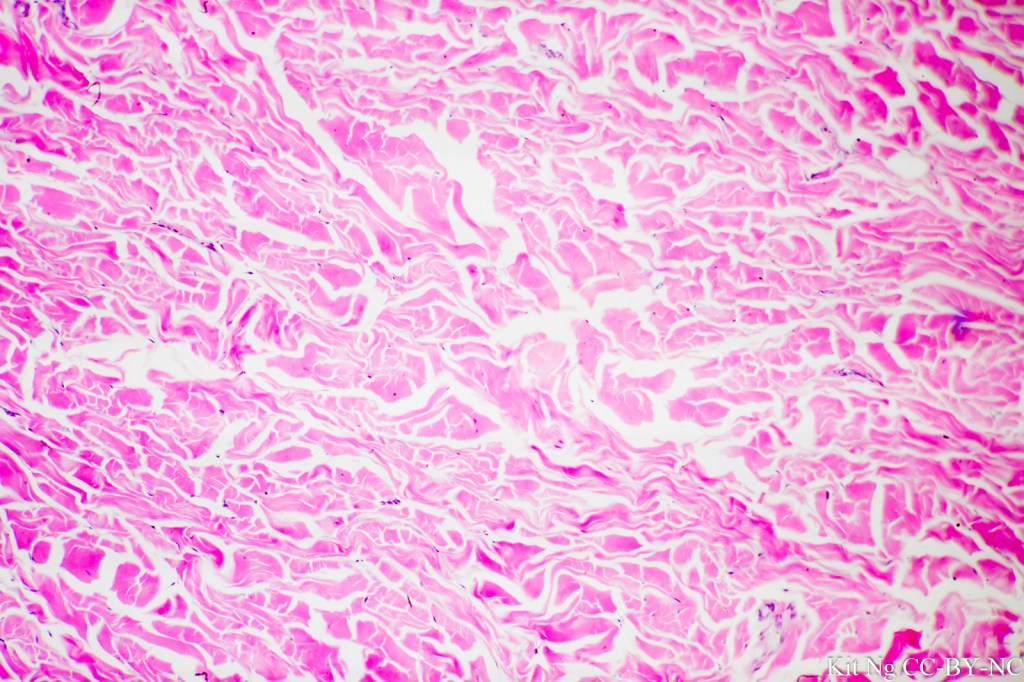 Dense Irregular Connective Tissue – Kit Ng, Ph.D.