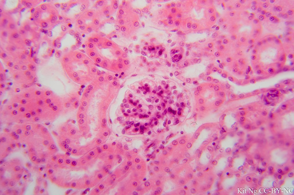 Simple Squamous Epithelium – Kit Ng, Ph.D.