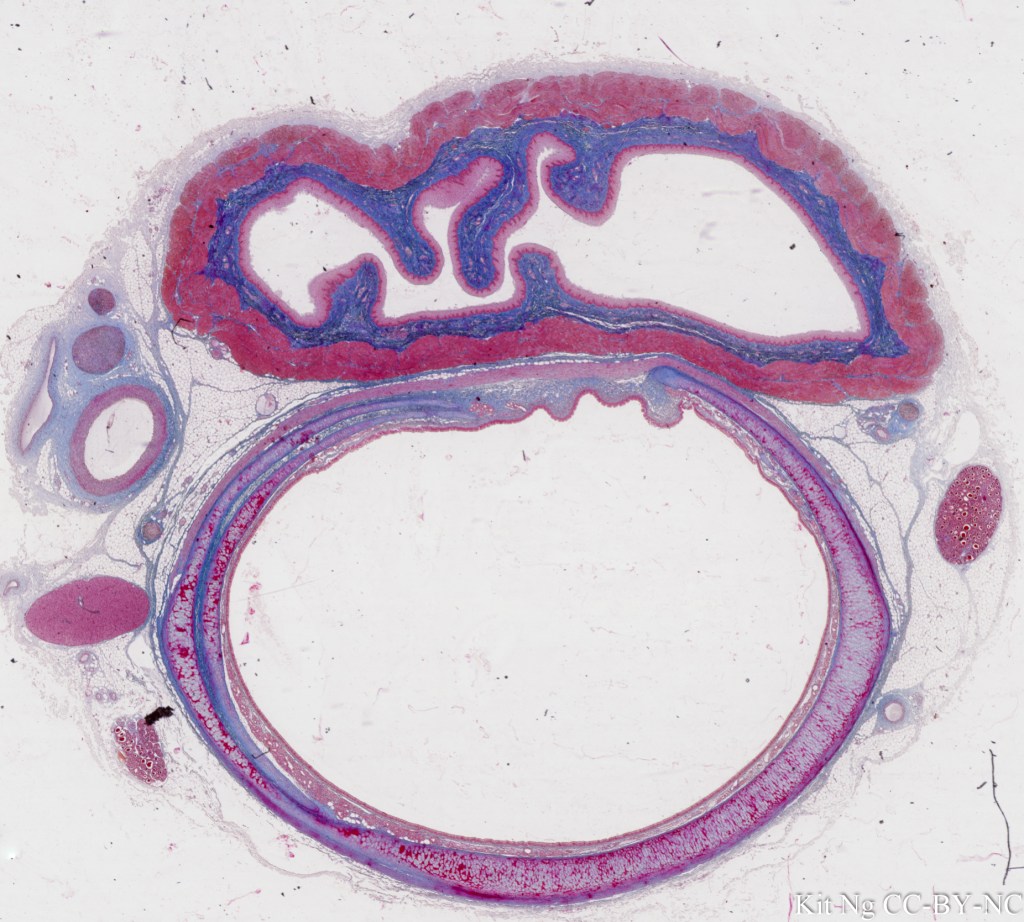 Trachea – Kit Ng, Ph.D.