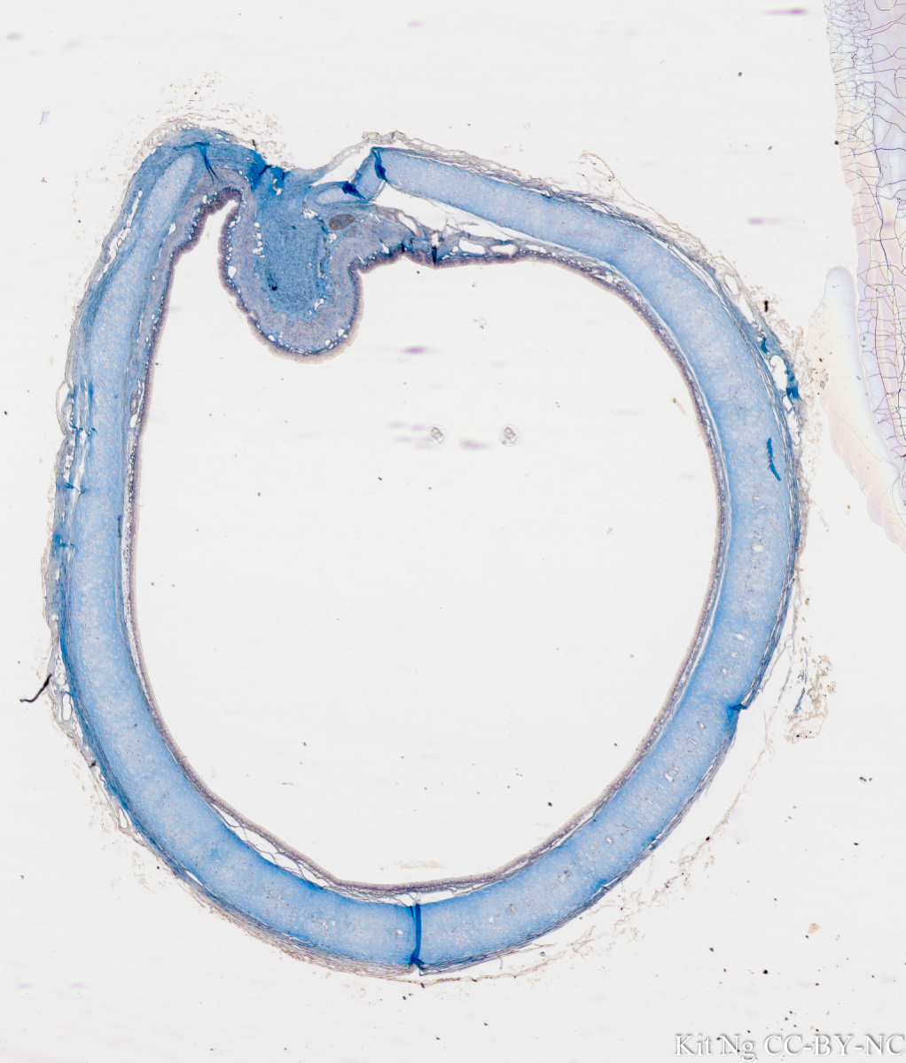 Trachea – Kit Ng, Ph.D.
