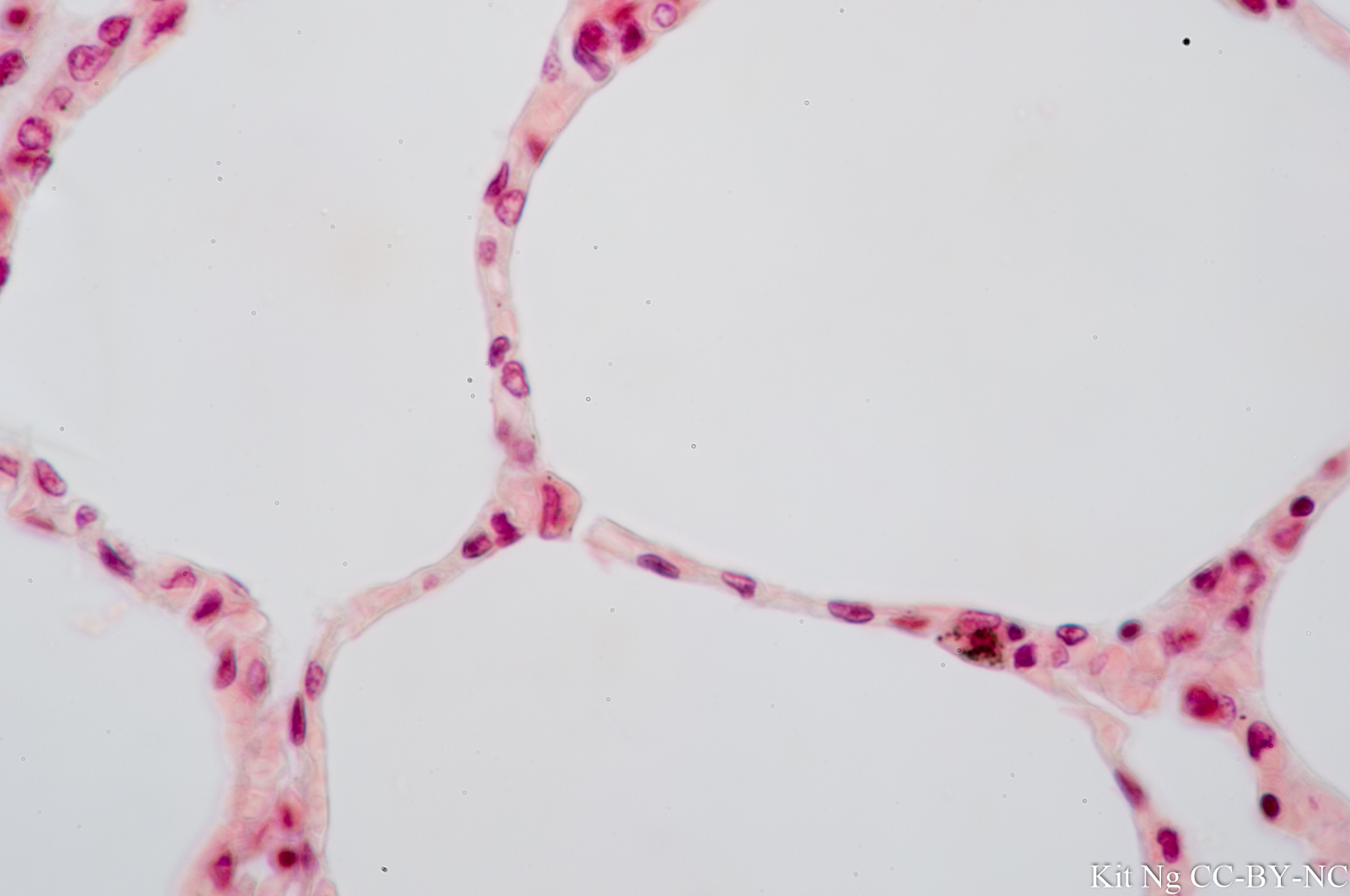 Simple Squamous Epithelium – Kit Ng, Ph.D.