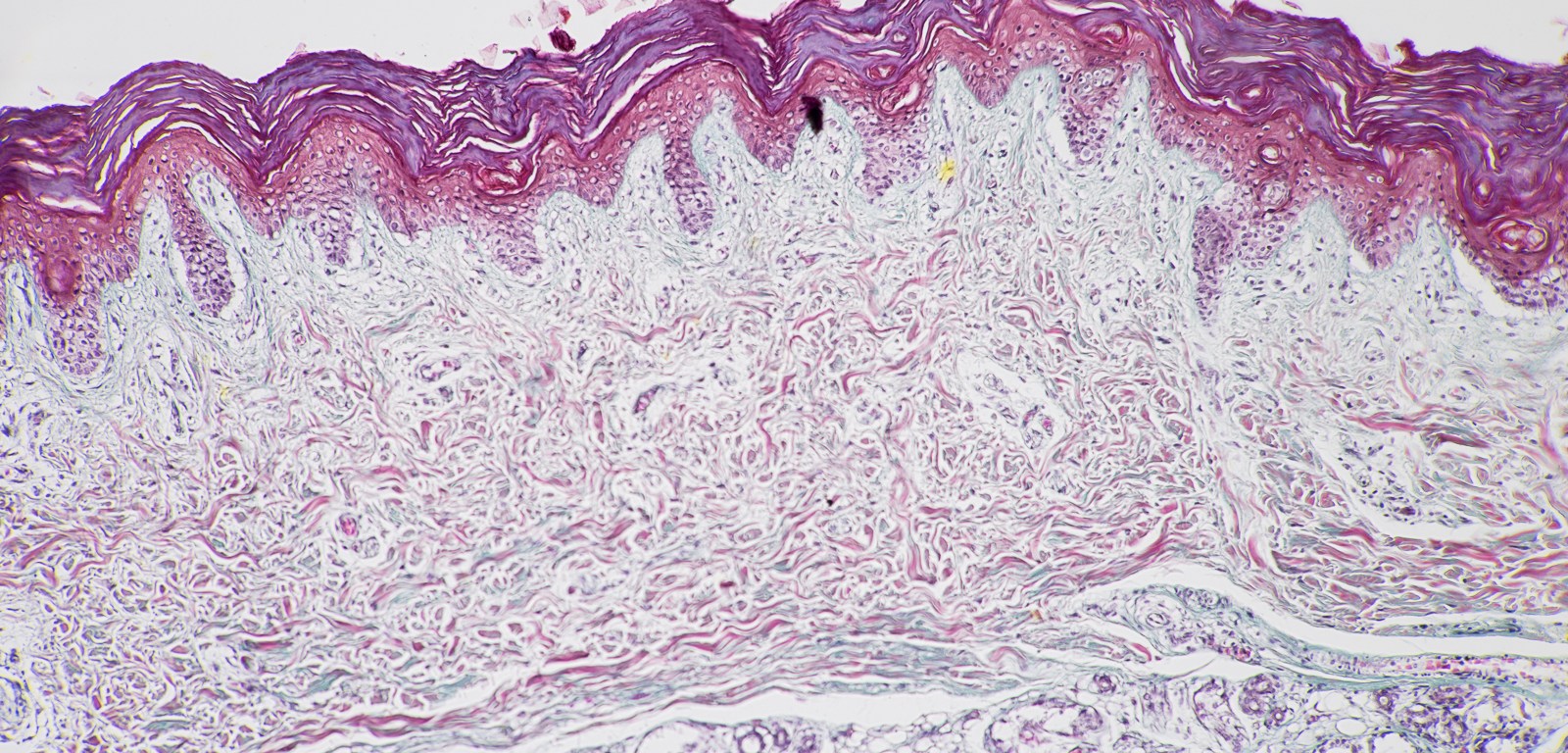 Layers Of Skin Histology 2 Skin Histology With Garland At