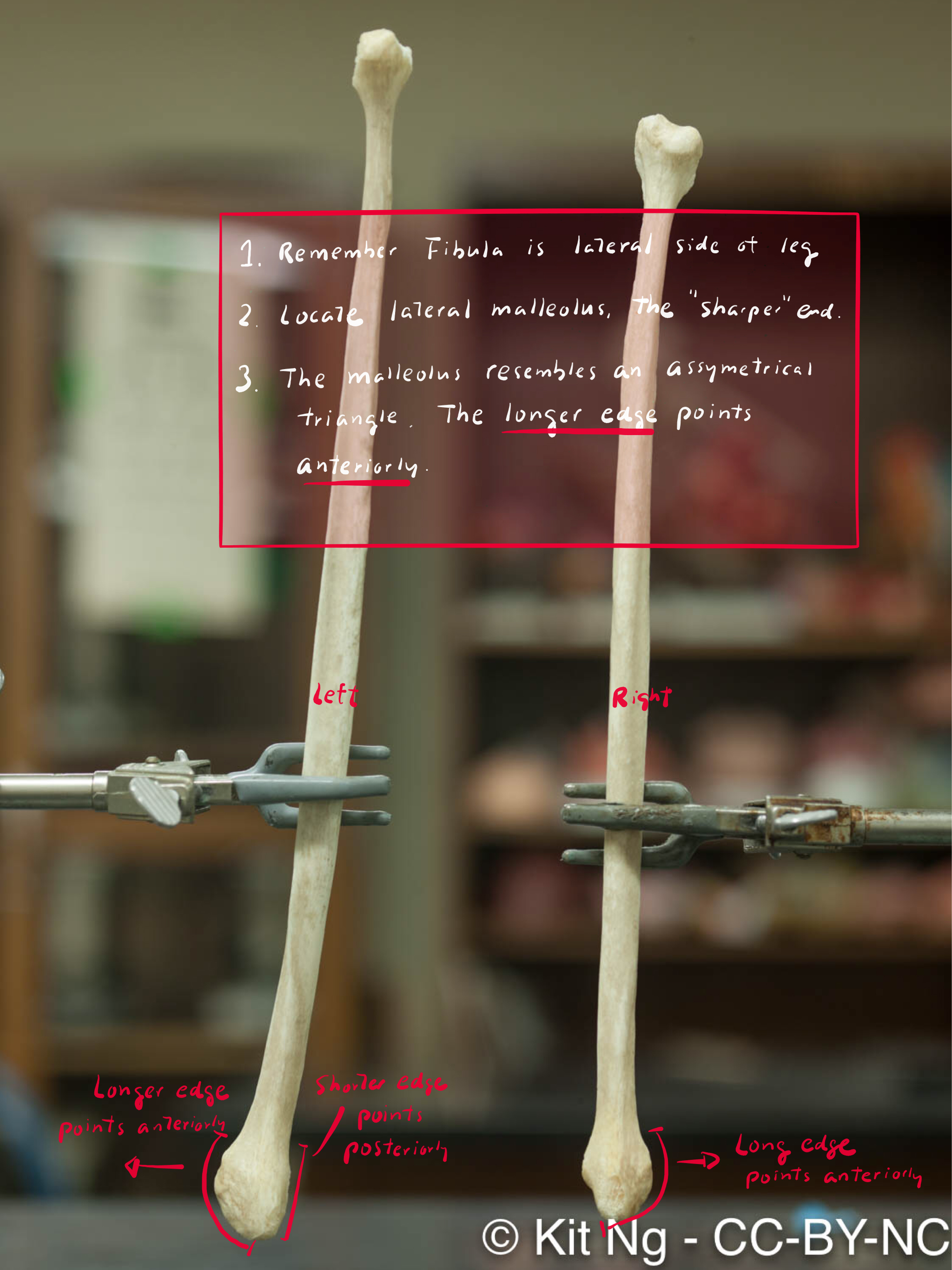 Fibula – Left/Right – Kit Ng, Ph.D.