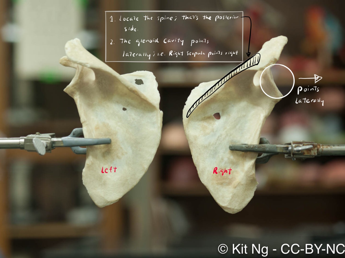 Scapula – Left/Right – Kit Ng, Ph.D.