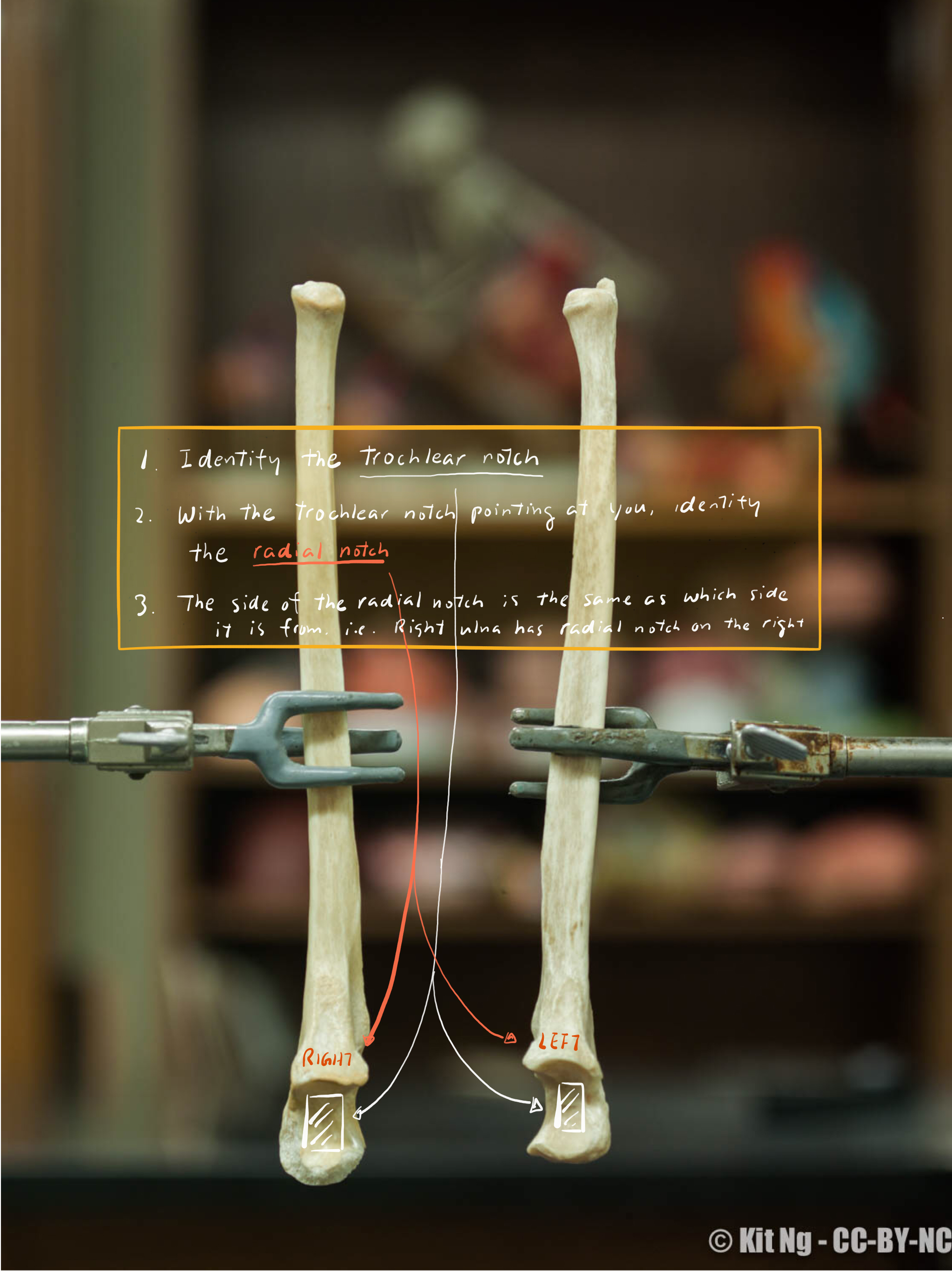 Ulna – Left/Right – Kit Ng, Ph.D.