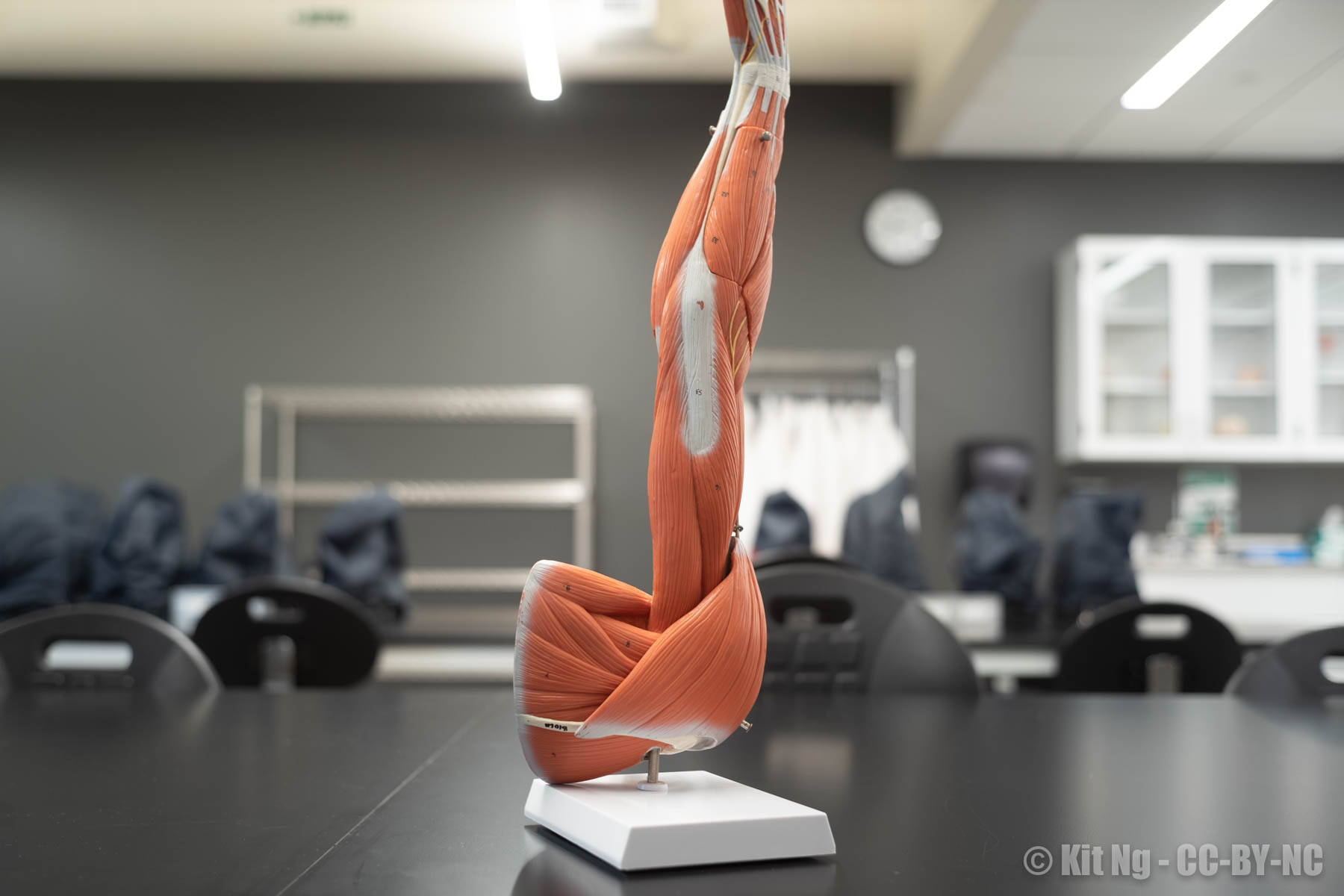 Upper Limb – Kit Ng, Ph.D.